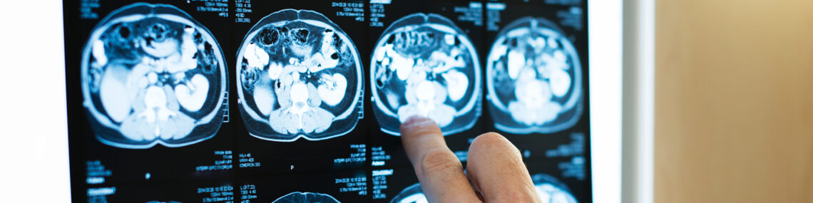 Brain Research Foundation Founding Story & Leadership