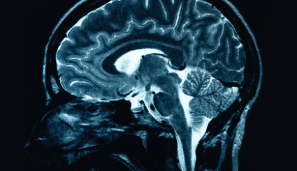 Brain | Brain Research Foundation